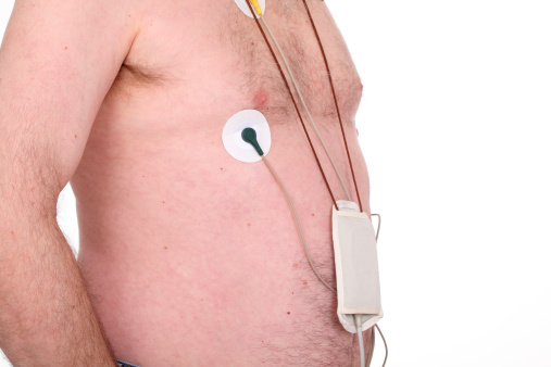 Holter - e-Med Case: Medical Cases